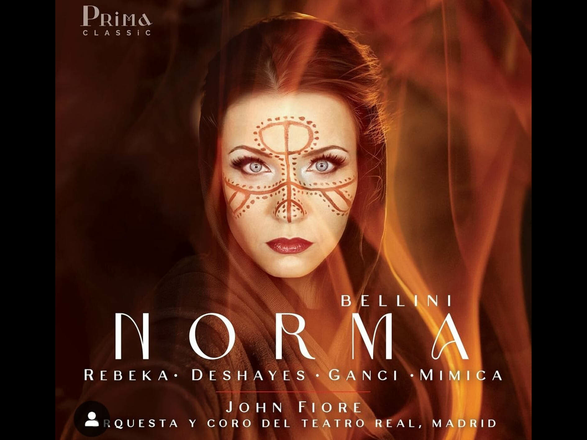 La Norma avec Marina Rebeka et Karine Deshayes immortalisée au disque ...